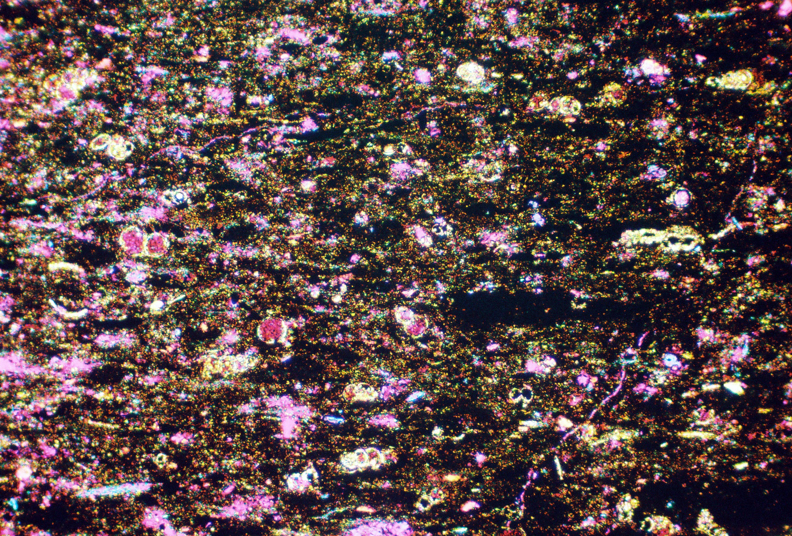 Organic Rich Shale Photomicrographs - Integrated Exploration Services, Inc.